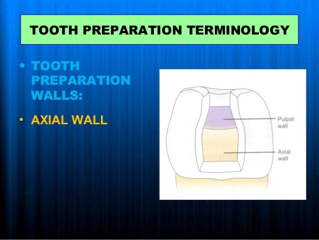 Fundamentals of tooth preparation 2013