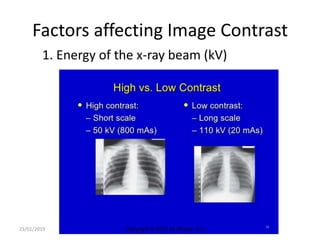 Fundamentals of x ray imaging i | PDF