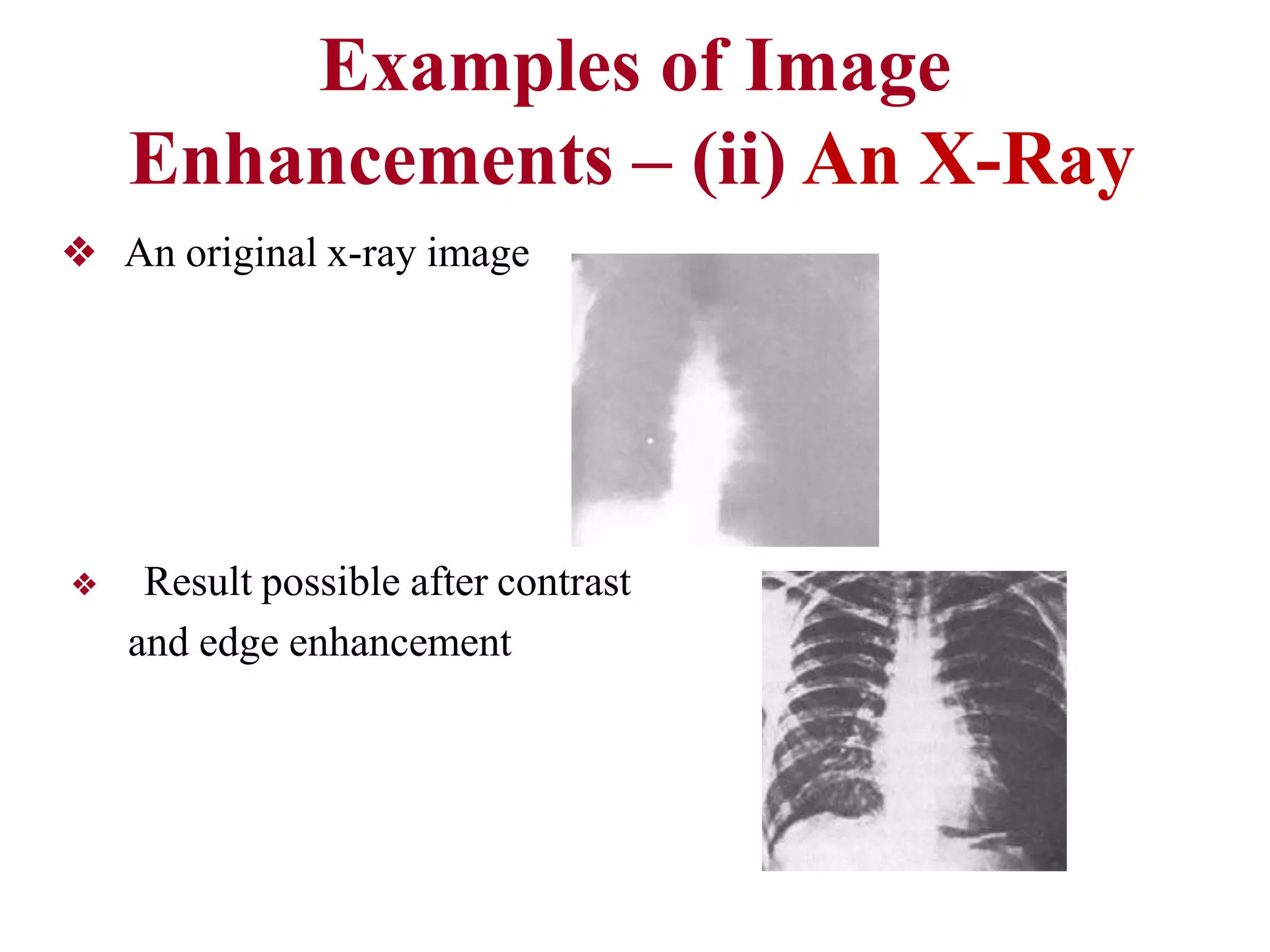 Fundamental steps in image processing | PPTX