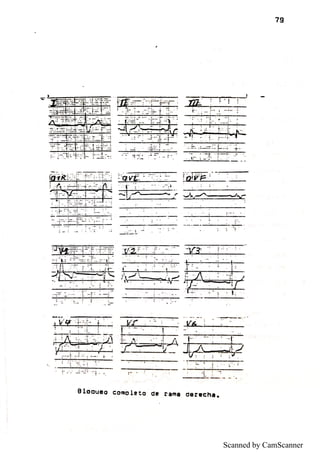 Fundamentos de electrocardiografia.dr. edgar segarra. | PDF