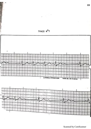 Fundamentos de electrocardiografia.dr. edgar segarra. | PDF