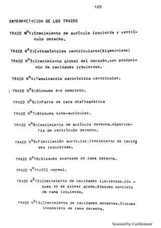 Fundamentos de electrocardiografia.dr. edgar segarra. | PDF