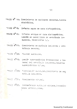 Fundamentos de electrocardiografia.dr. edgar segarra. | PDF