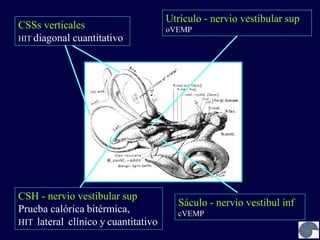 Fundamentos exploración vestibuar | PPTX