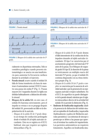 Fundamentos practicos en anestesiologia y reanimacion | PDF