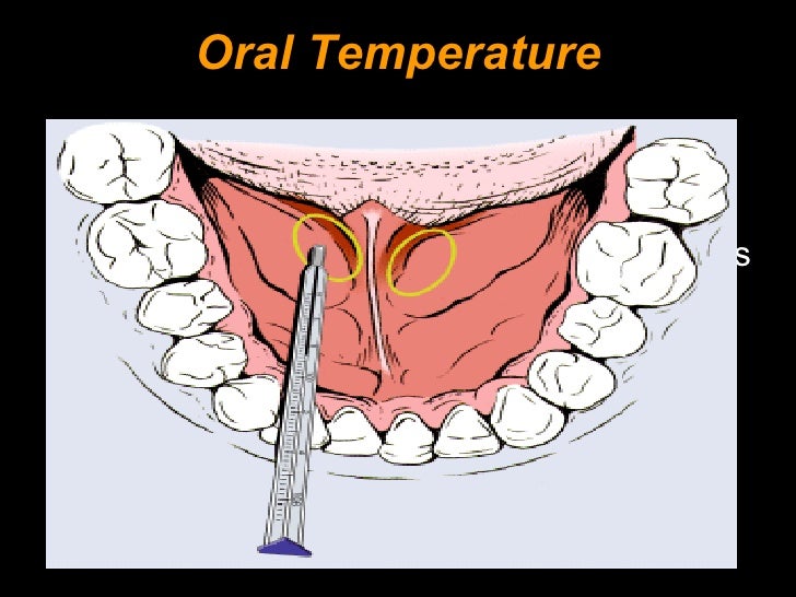 Funda mini movie clean