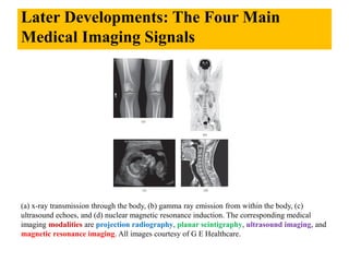 History & Principles of Medical Imaging: X-ray, Nuclear Medicine ...