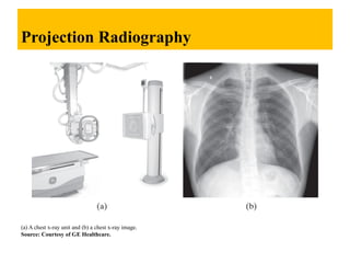 History & Principles of Medical Imaging: X-ray, Nuclear Medicine ...
