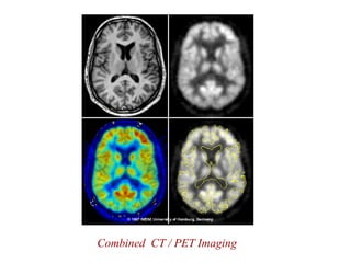 History & Principles of Medical Imaging: X-ray, Nuclear Medicine ...