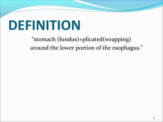Fundoplication and heller's myotomy | PPT