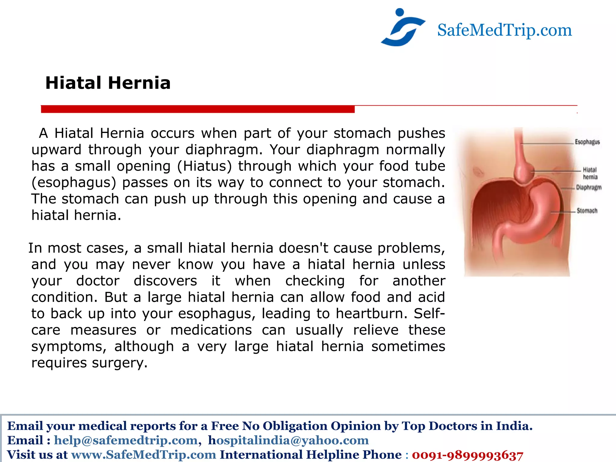 Highly Advanced Laparoscopic Fundoplication Surgery for ...