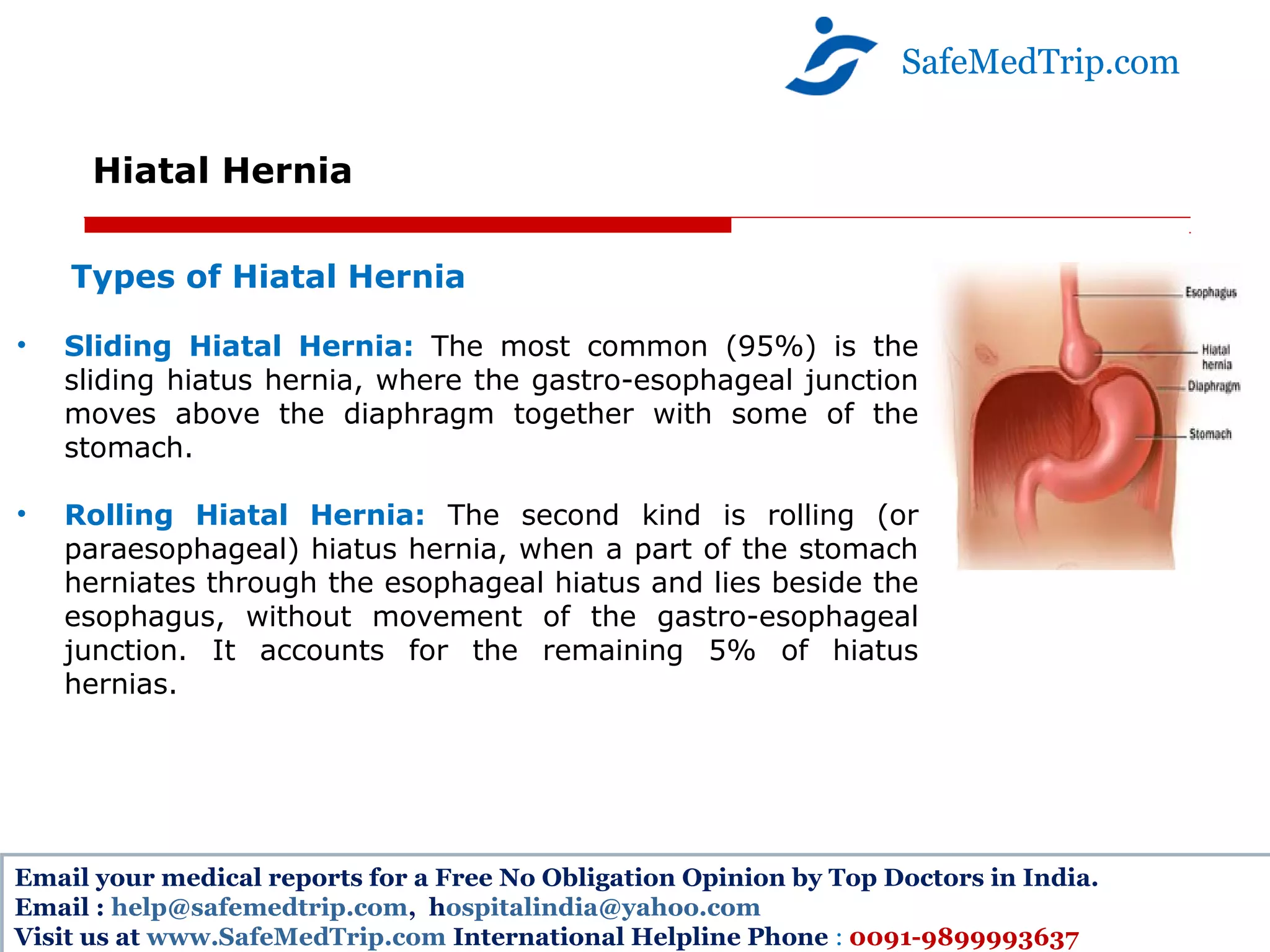 Highly Advanced Laparoscopic Fundoplication Surgery for ...