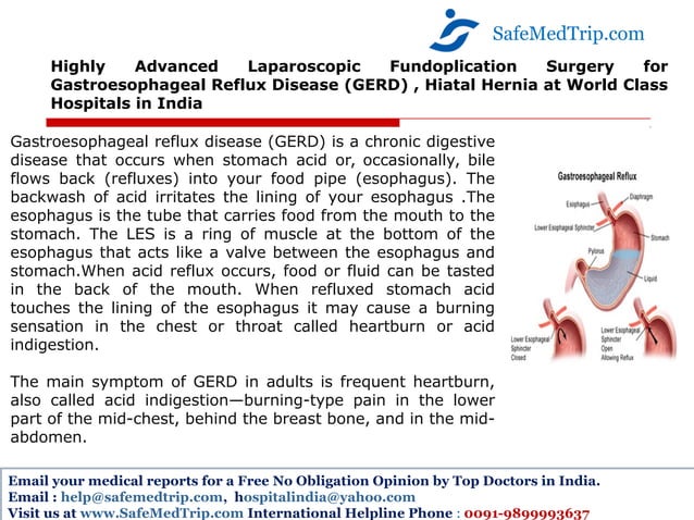 Highly Advanced Laparoscopic Fundoplication Surgery for ...
