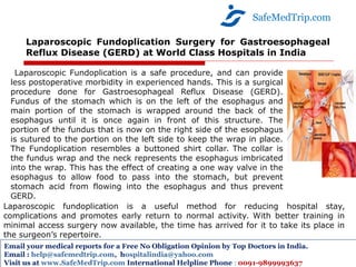 Highly Advanced Laparoscopic Fundoplication Surgery for Gastroesophageal Reflux Disease (GERD) | PDF