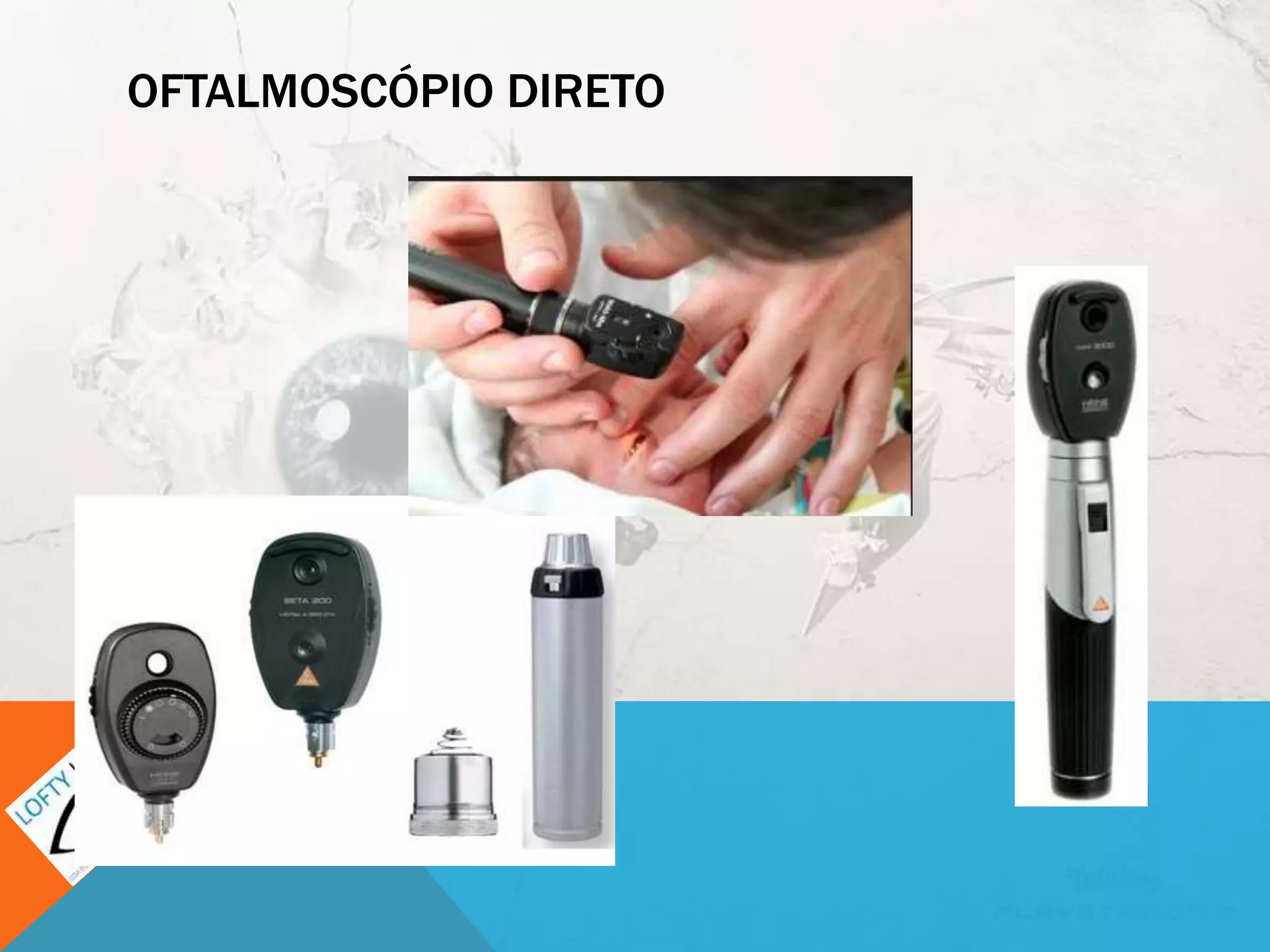 Fundoscopia direta | PPTX | Eye and Vision Conditions | Diseases and ...