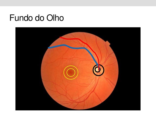 Fundoscopia para iniciantes