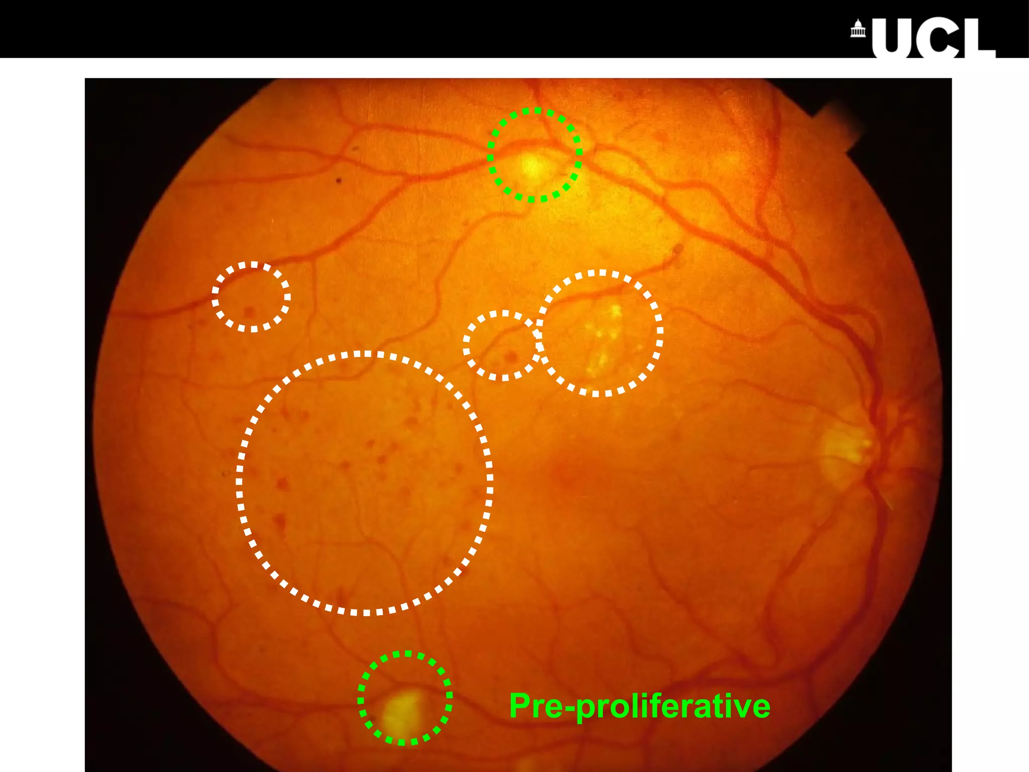 Fundoscopy OSCE | PPT