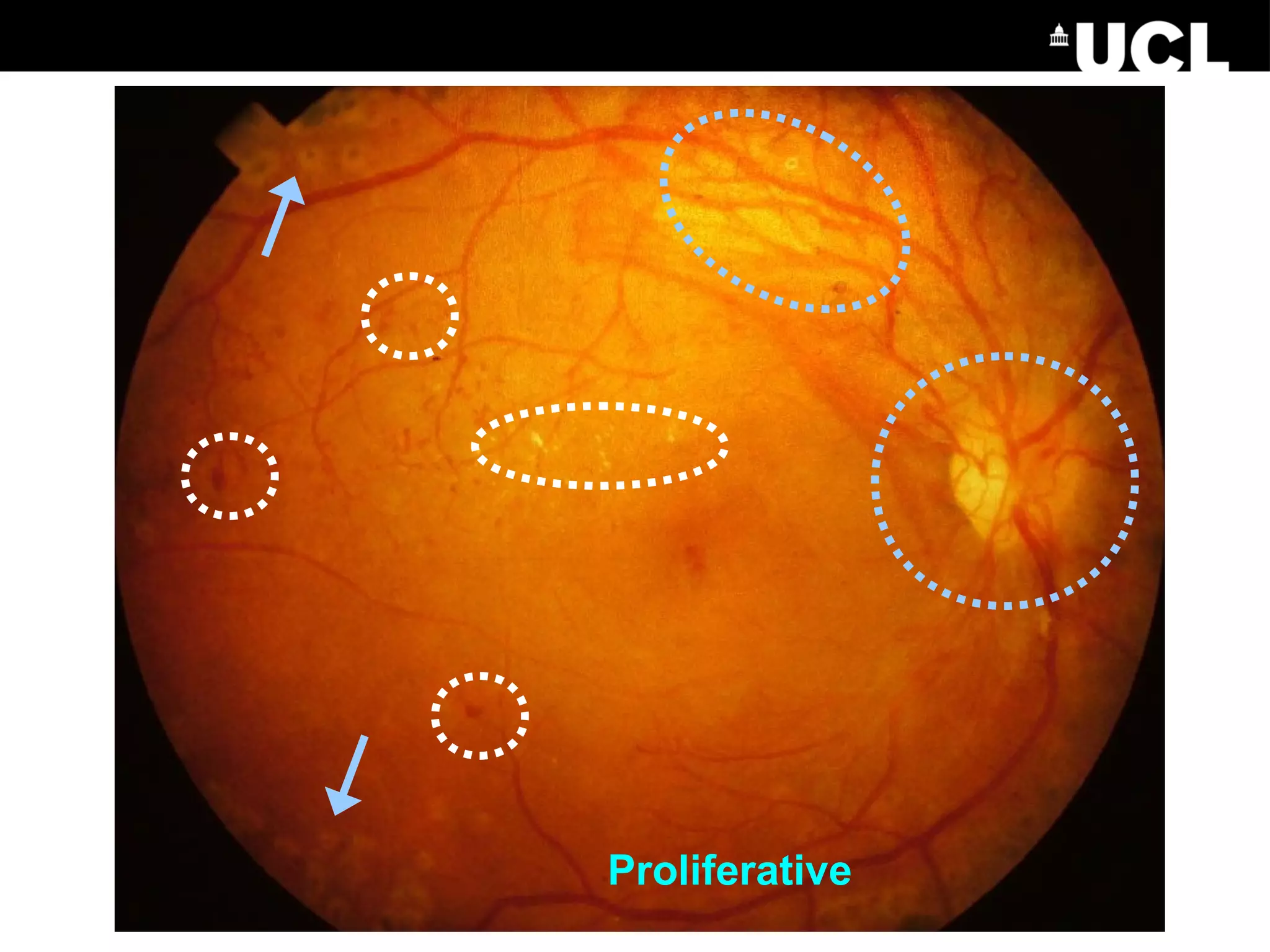 Fundoscopy OSCE | PPT