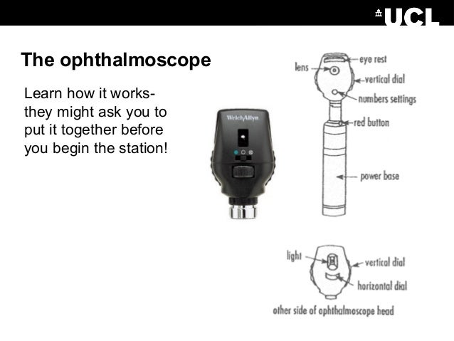 Fundoscopy OSCE