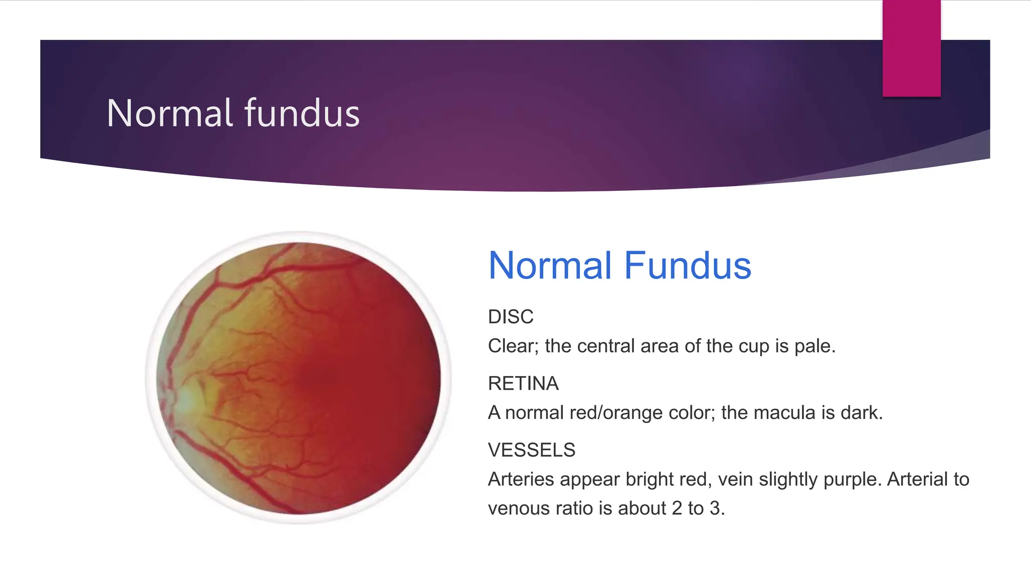 Fundoscopy images-1.pptx