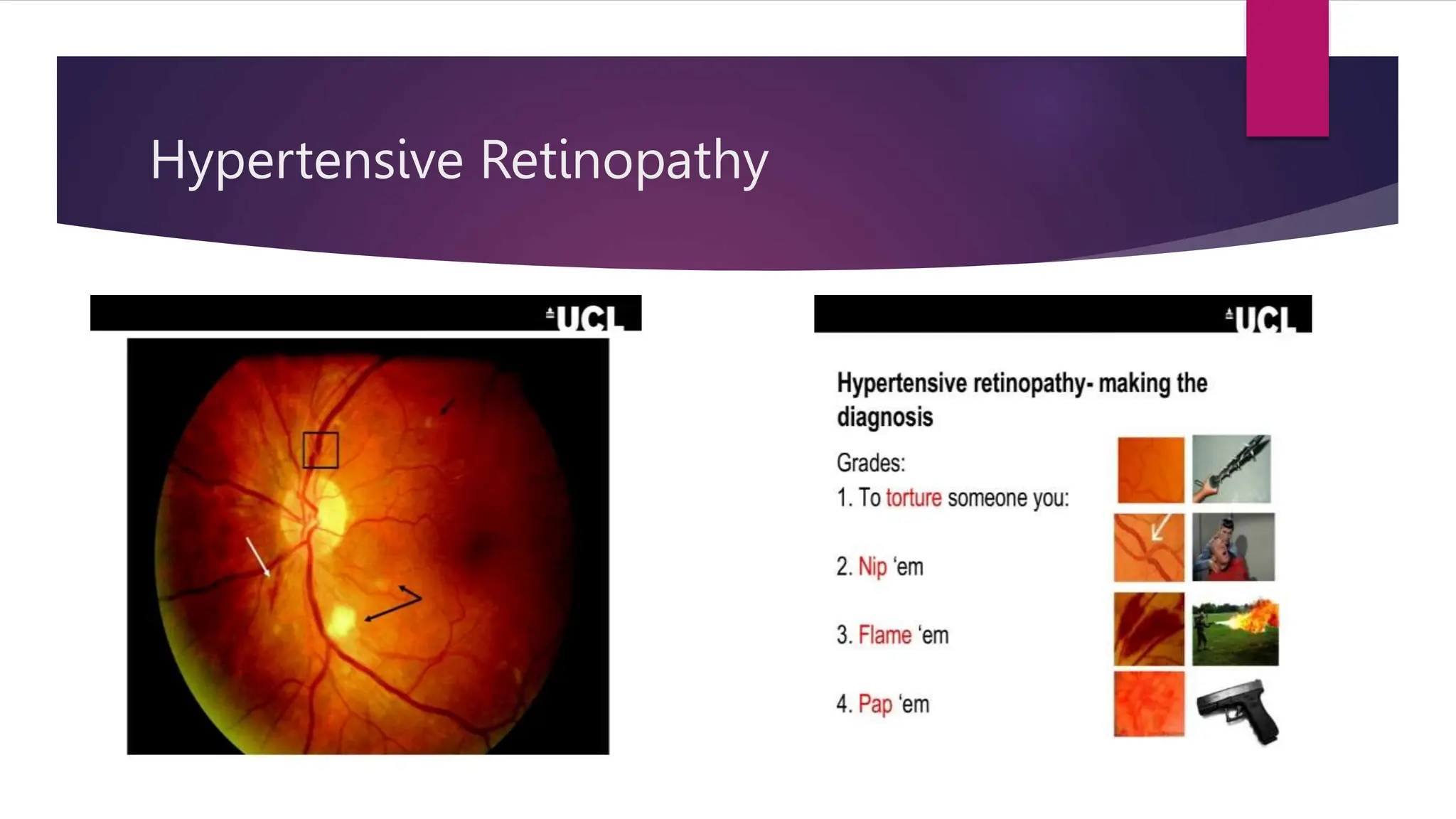 Fundoscopy images-1.pptx