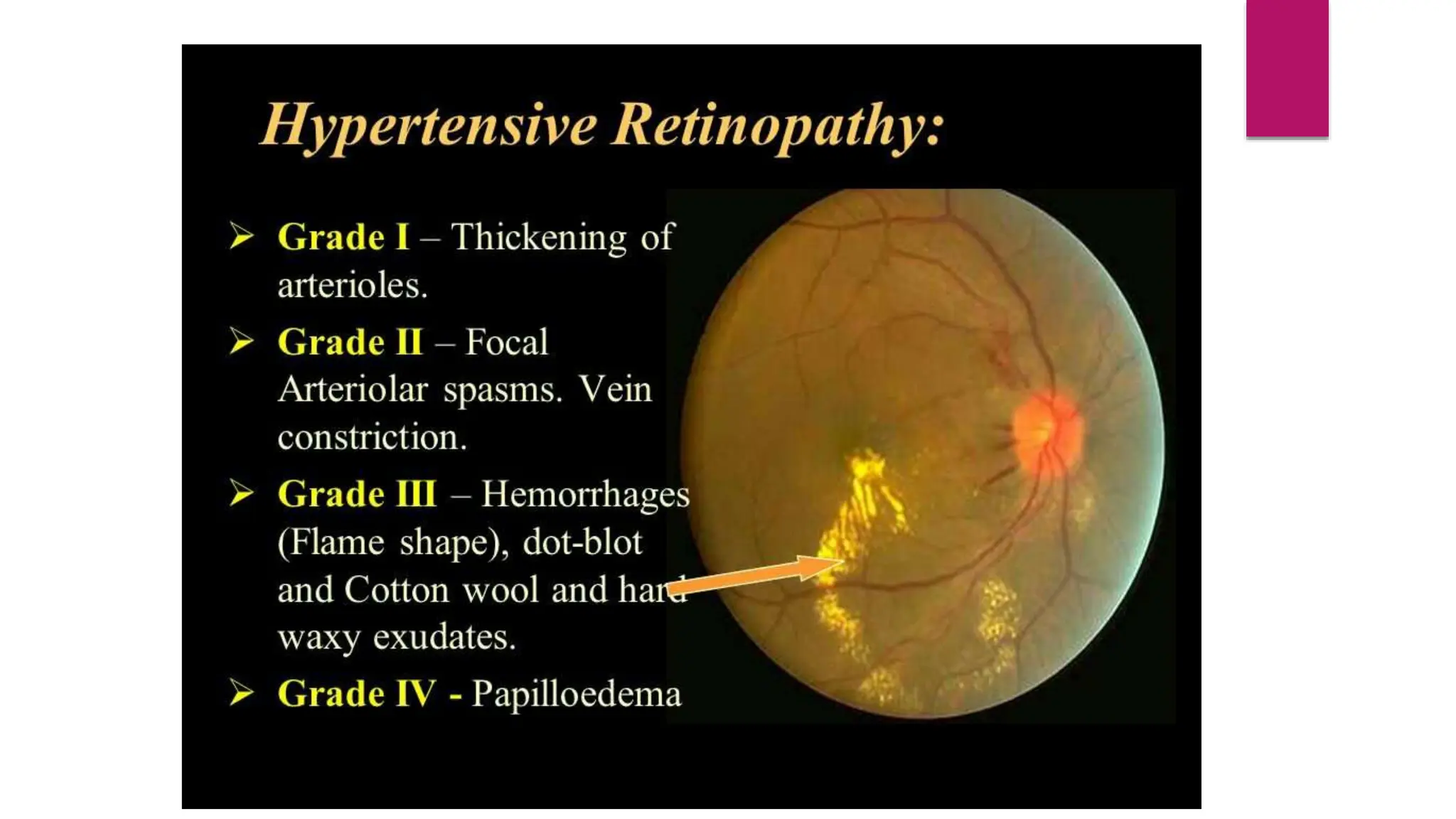 Fundoscopy images-1.pptx