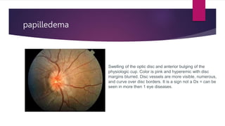 Fundoscopy images-1.pptx