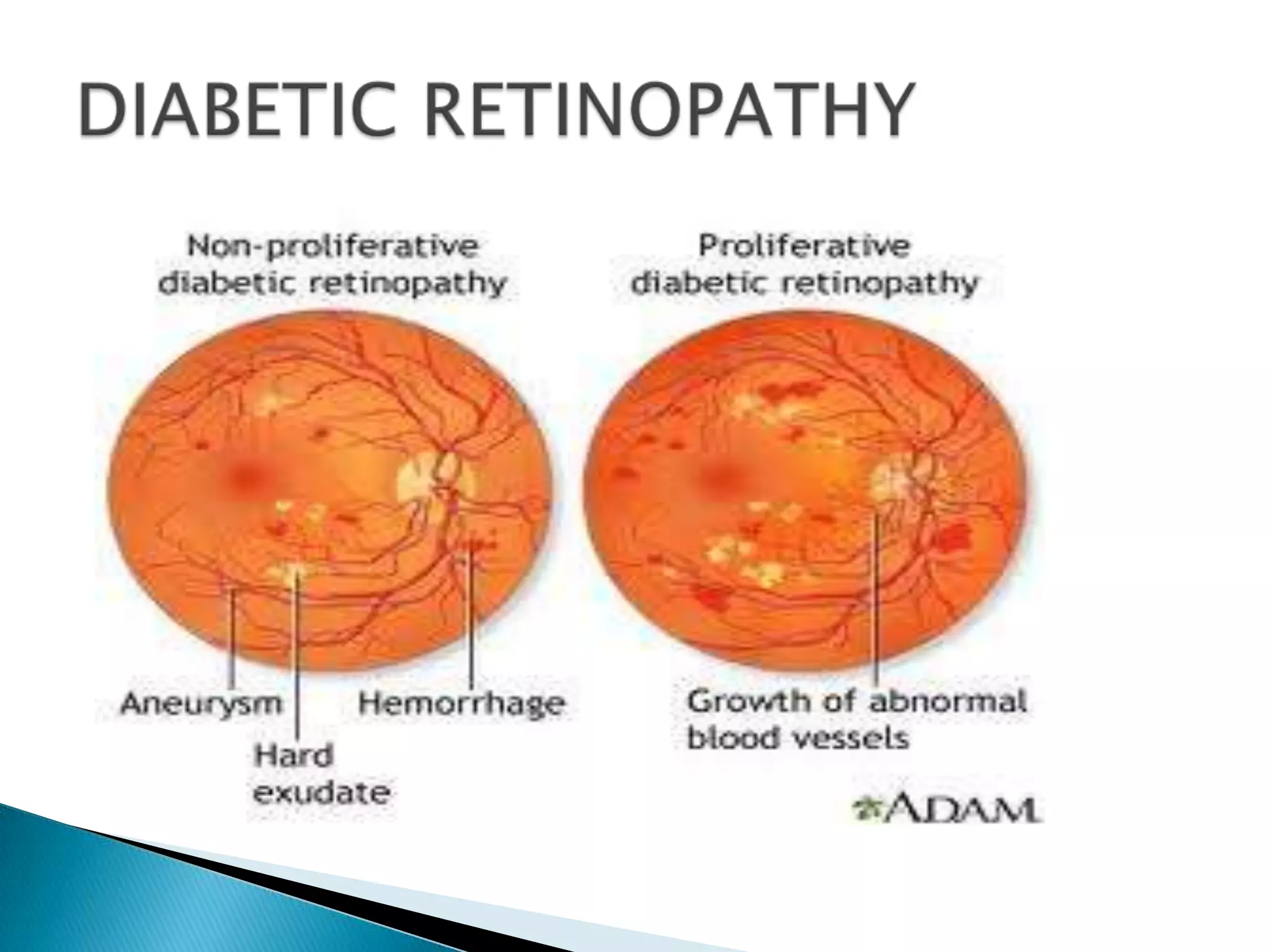 Fundoscopy ppt 2012 | PPTX