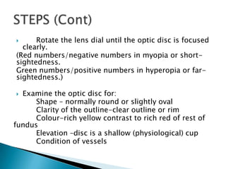 Fundoscopy ppt 2012 | PPTX