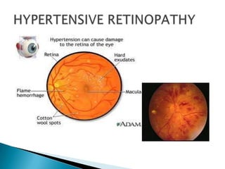 Fundoscopy ppt 2012 | PPTX