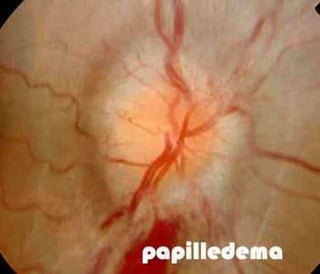 Fundus examination | PDF