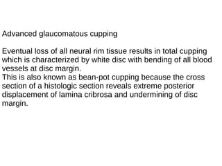 Fundus in Glaucoma | ODP