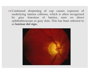 Glaucoma Fundus