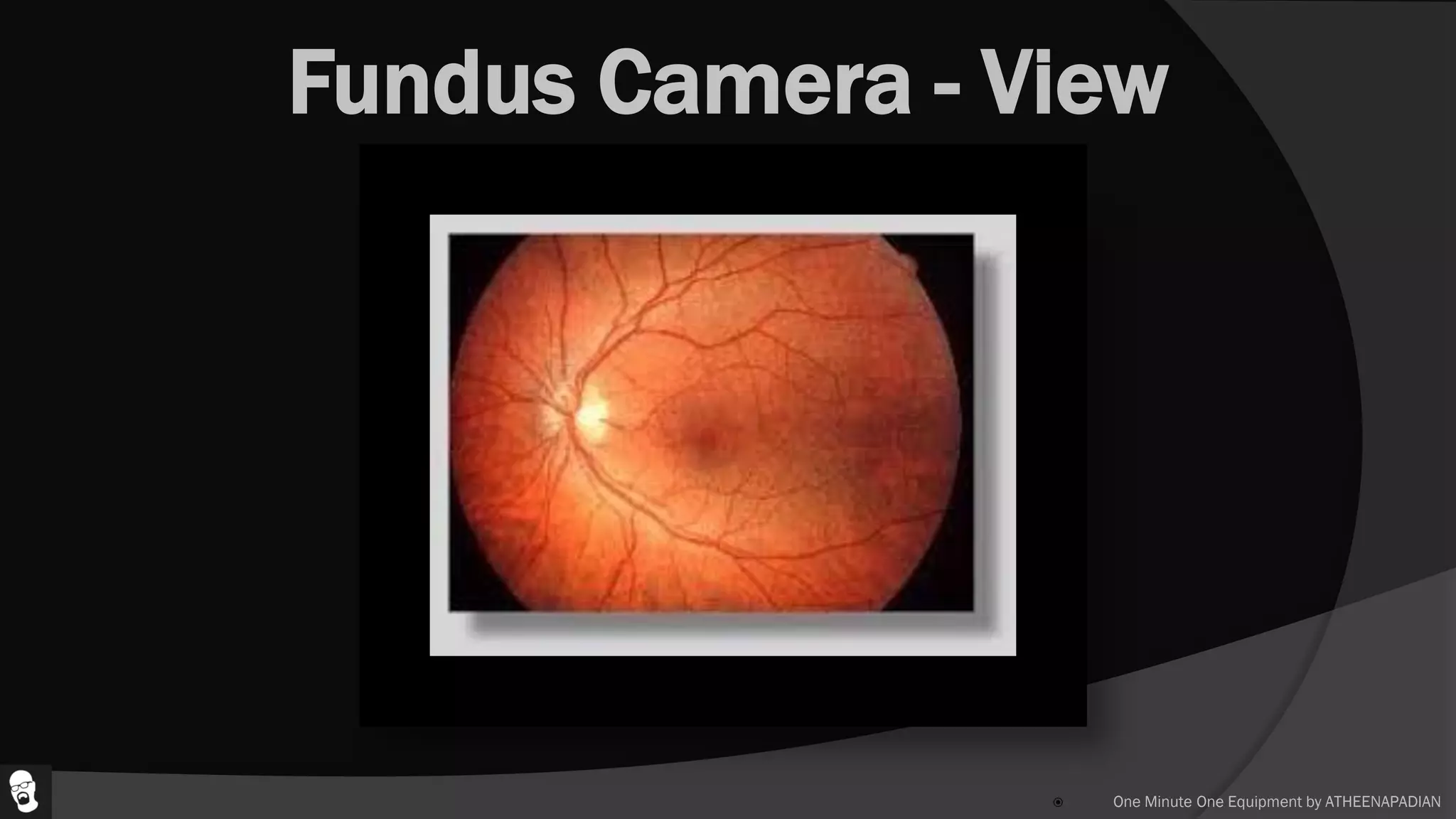 Fundus camera - Medical Equipment | PDF