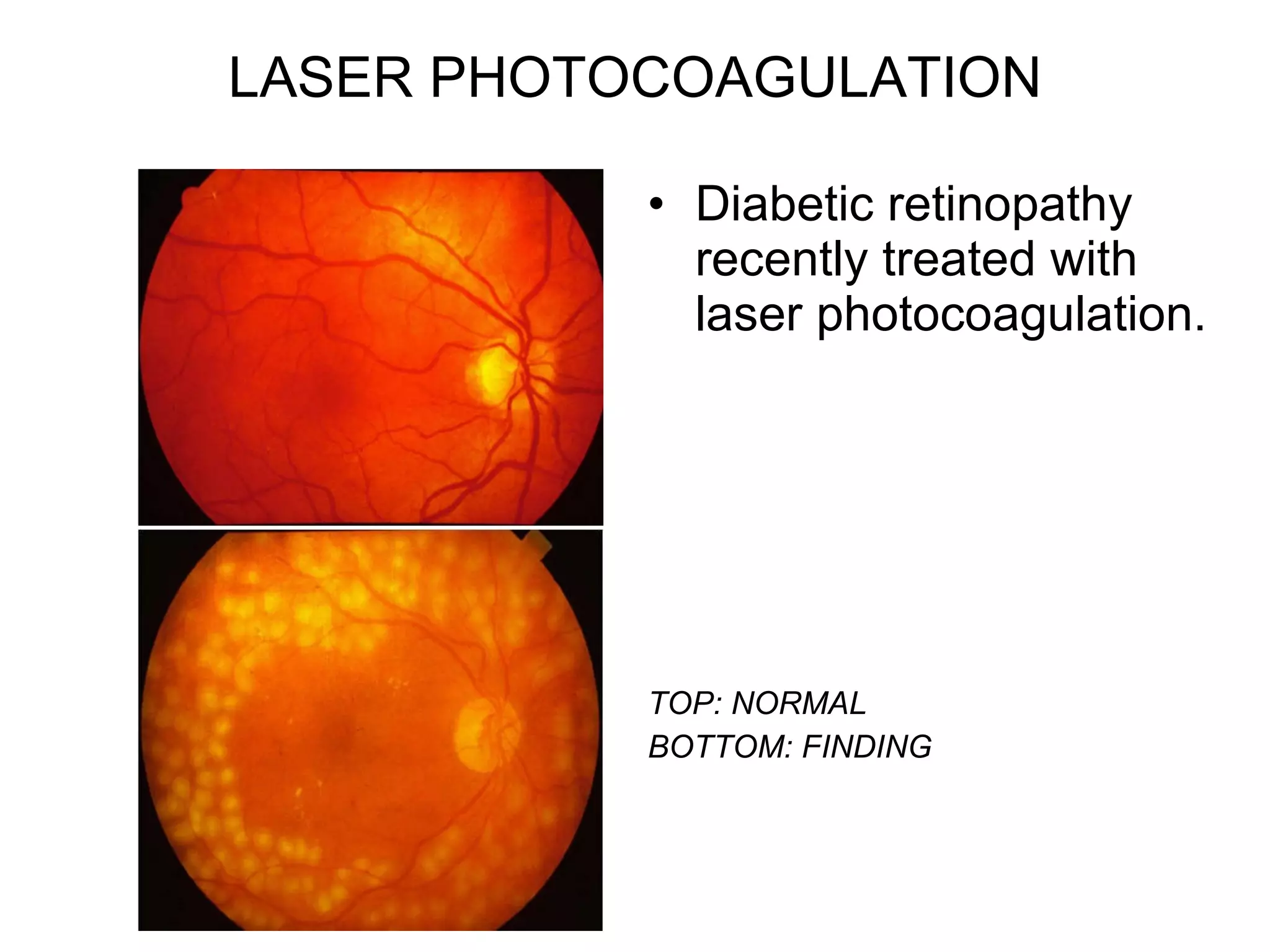 Funduscopy | PPT