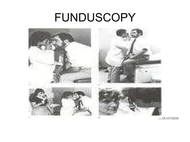 Funduscopy | PPT