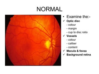 Funduscopy | PPT