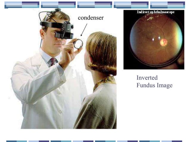 Funduscopy | PPTX