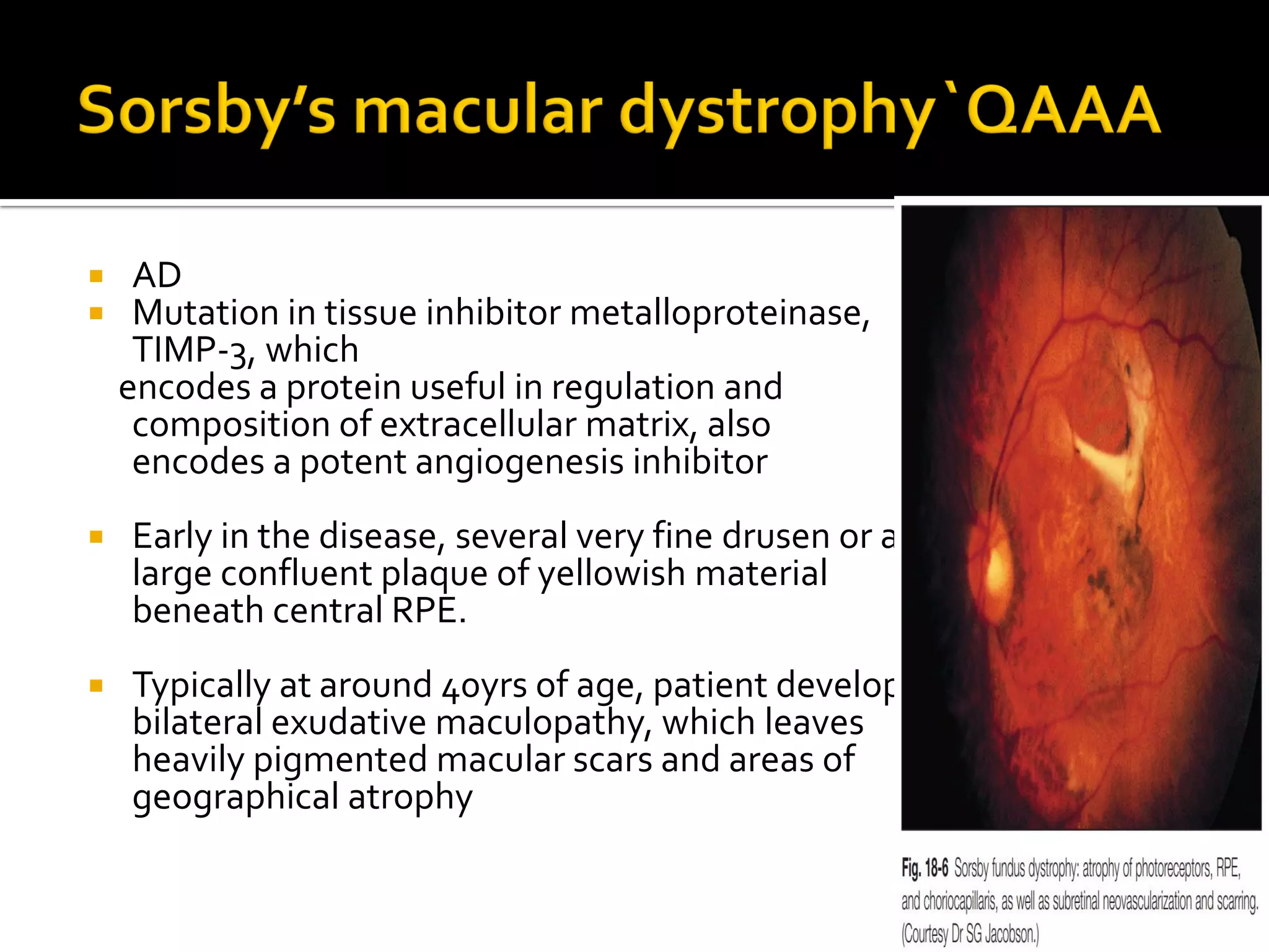 hereditary macular and choroidal dystrophies | PDF | Eye and Vision ...