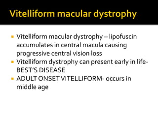 hereditary macular and choroidal dystrophies | PDF | Eye and Vision ...