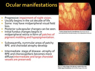 hereditary macular and choroidal dystrophies | PPT