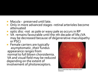 hereditary macular and choroidal dystrophies | PDF | Eye and Vision ...
