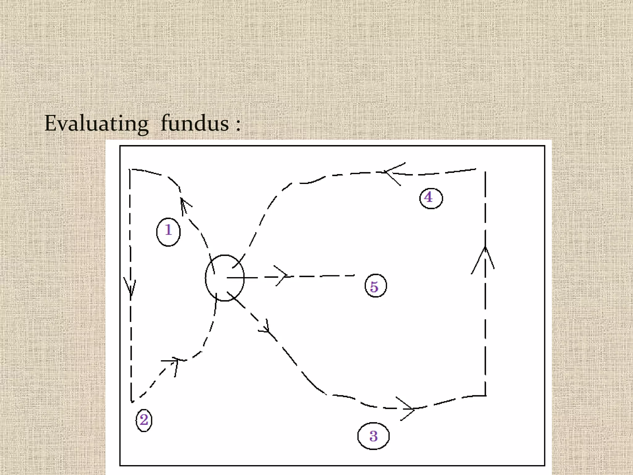 Fundus examination | PPT