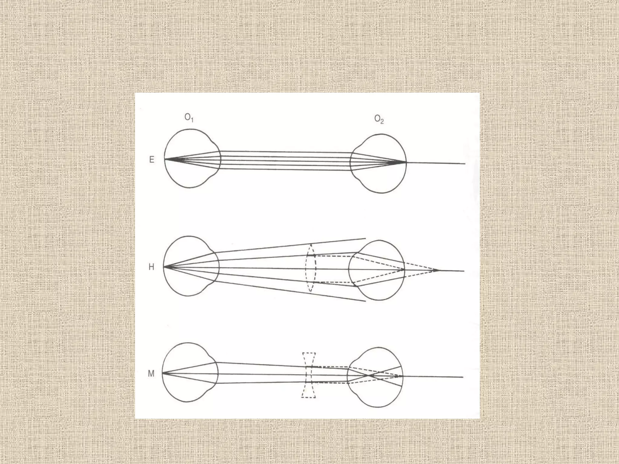 Fundus examination | PPT