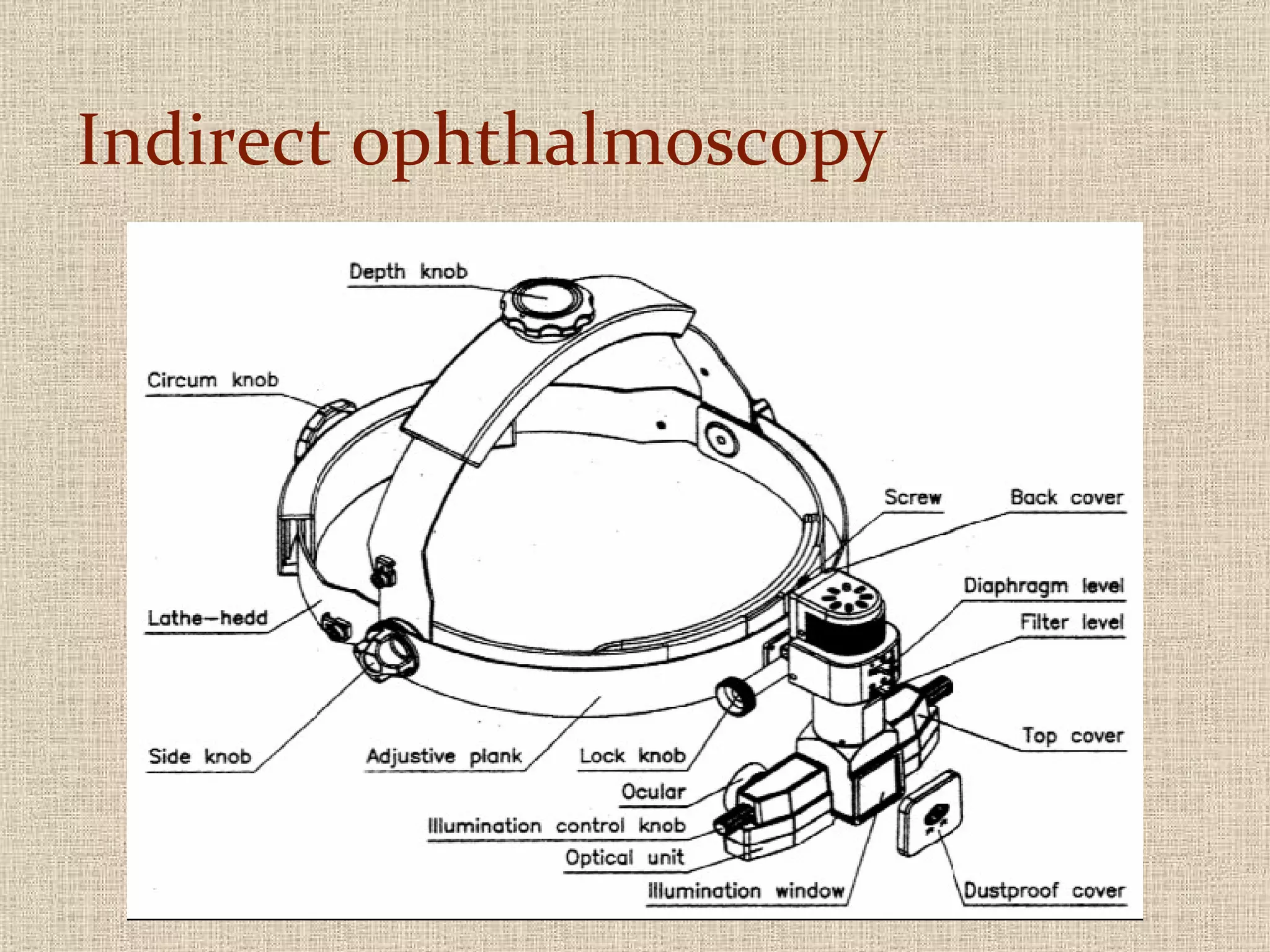 Fundus examination | PPT