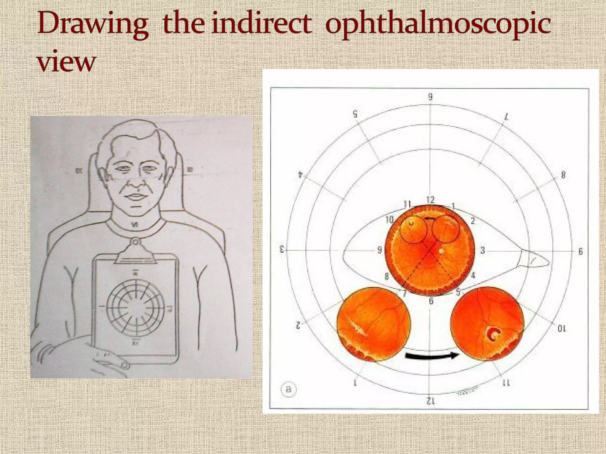 Fundus examination | PPT