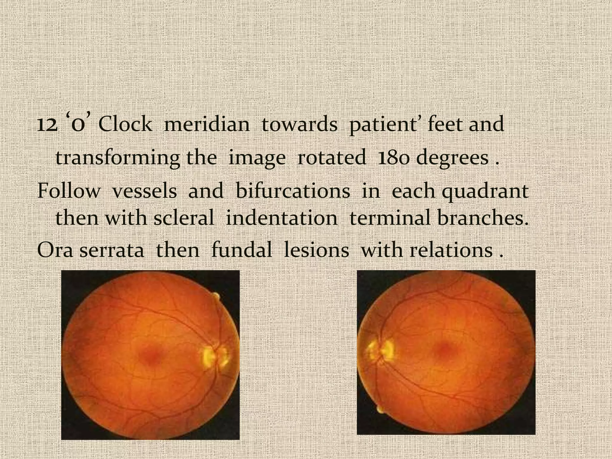 Fundus examination | PPT