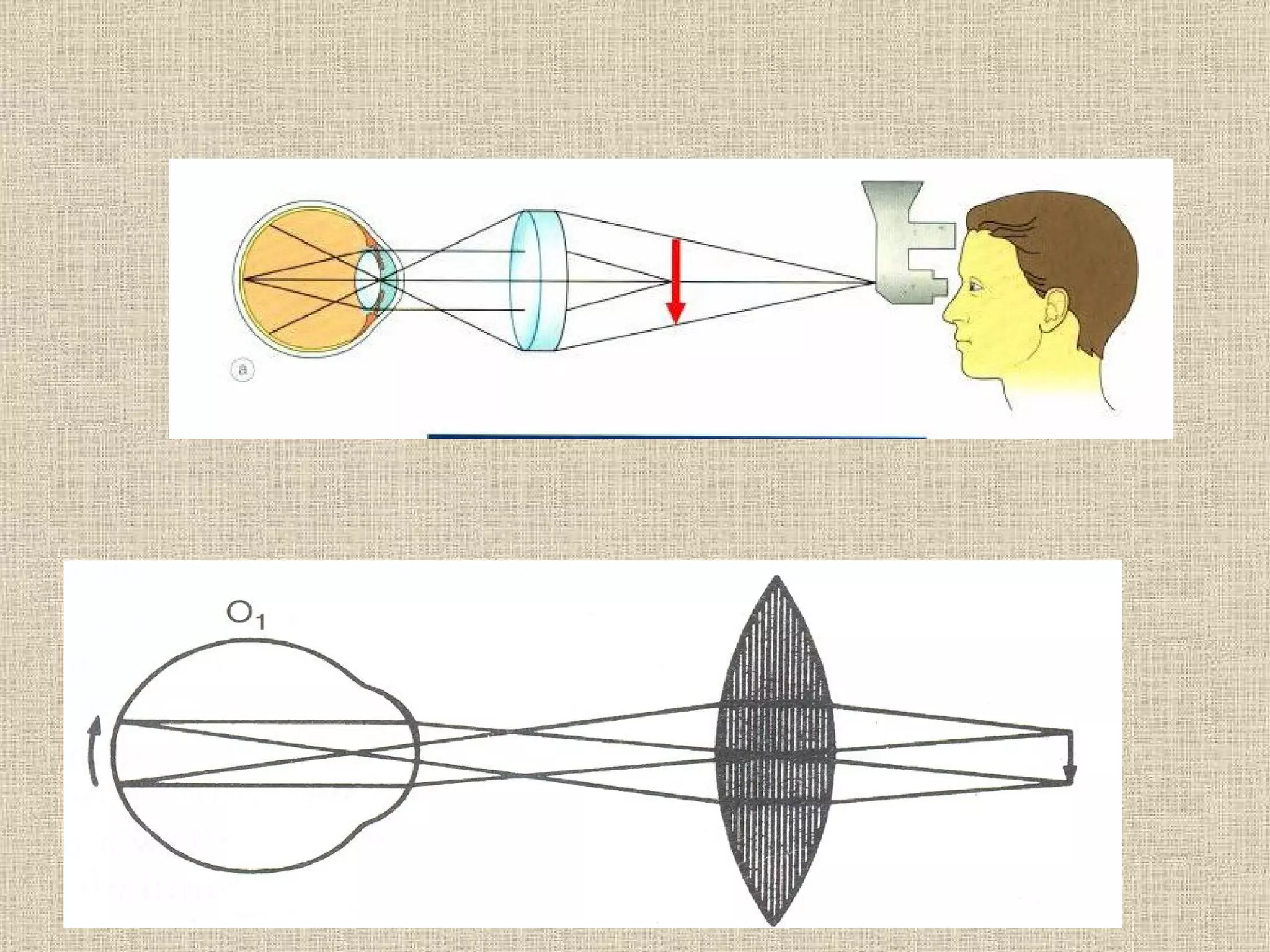 Fundus examination | PPT