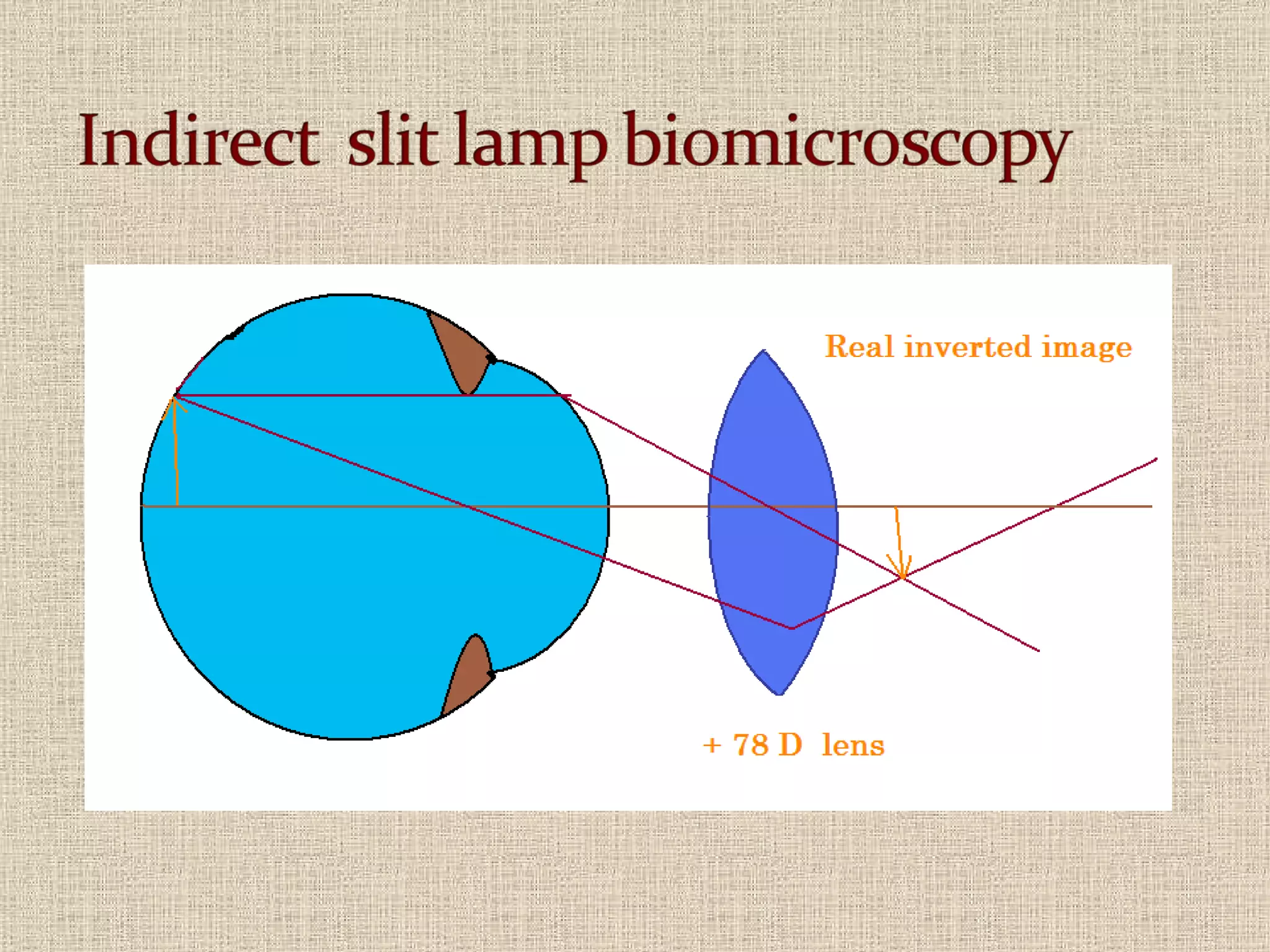 Fundus examination | PPT