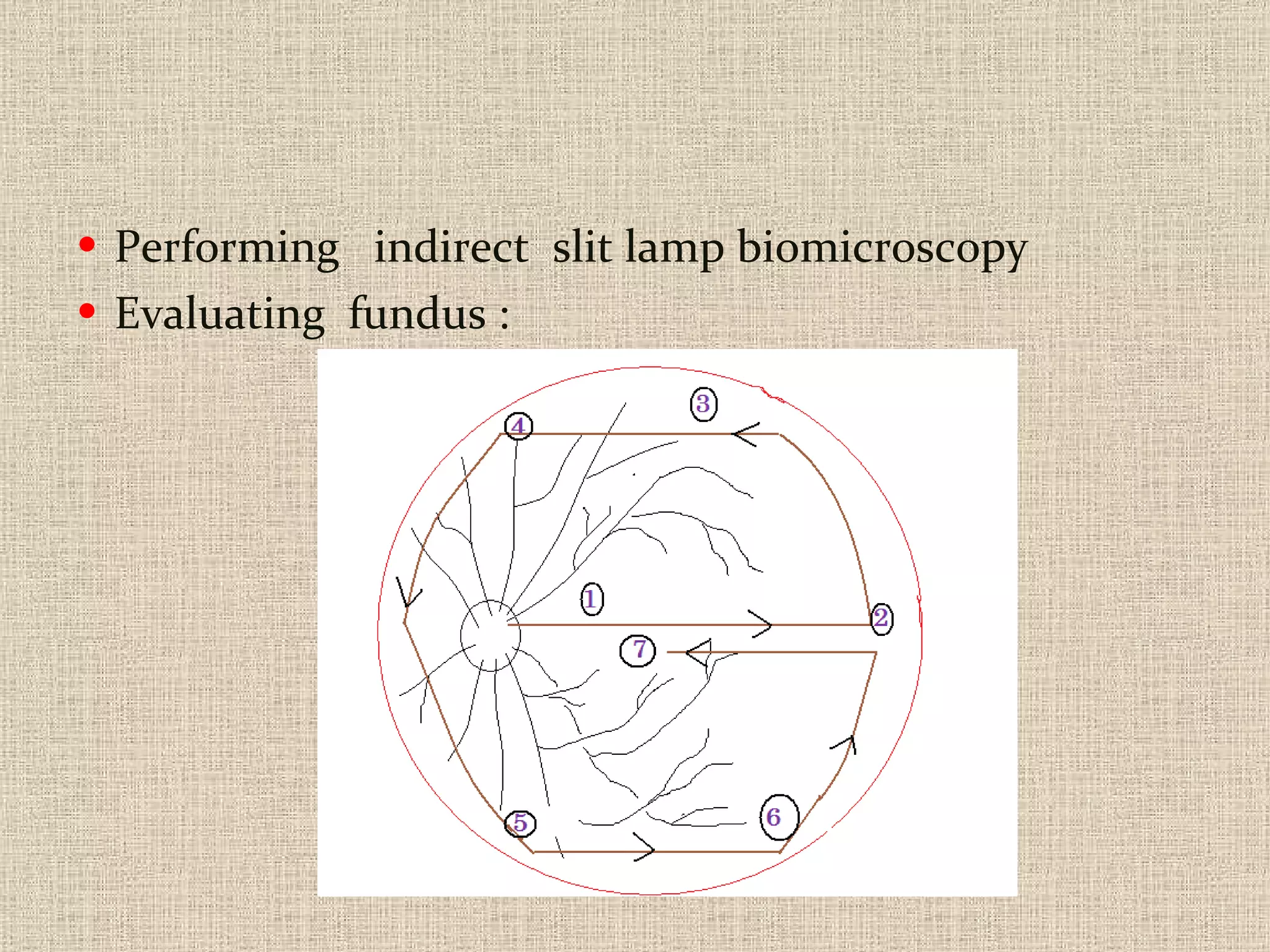 Fundus examination | PPT